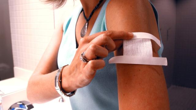 The Z-Track Method for IM Injections: FAQs